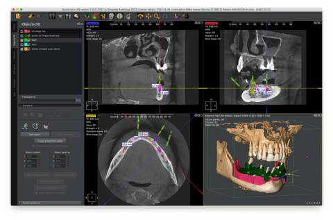 Dental Impression Scanner - Owandy-IOS