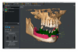 Dental Impression Scanner - Owandy-IOS