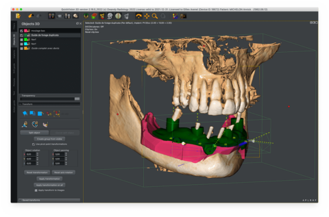Cephalometric dental panoramic X-ray - I-Max Ceph Pro