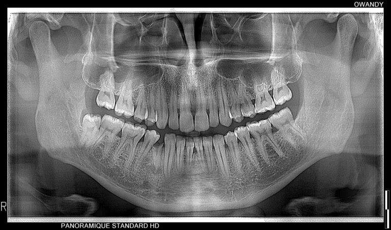 Cephalometric dental panoramic X-ray - I-Max Ceph Pro