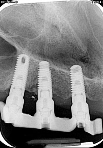 Owandy-CR2 - Dental Plate Scanner