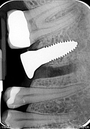 Owandy-CR2 - Dental Plate Scanner
