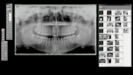 QuickVision - Dental Practice Management & Imaging Software