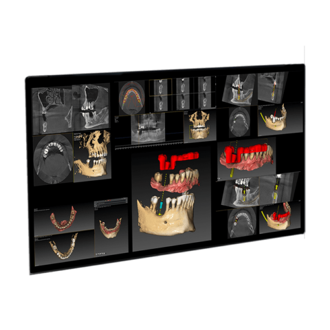 Quickvision Dental Practice Management Imaging Software