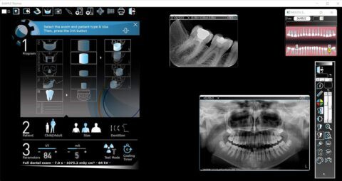 OPTEO Dental Intraoral Sensor - Owandy Radiology