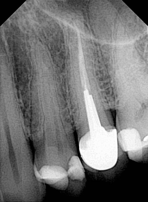 New OPTEO Dental Sensor - High-definition, reliable, and durable