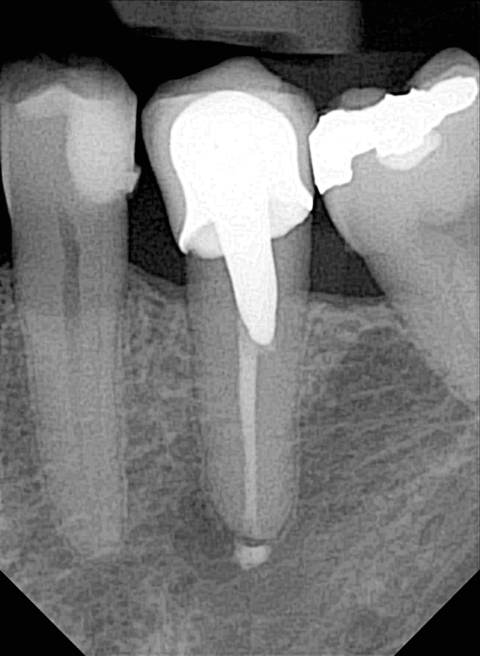 New OPTEO Dental Sensor - High-definition, reliable, and durable
