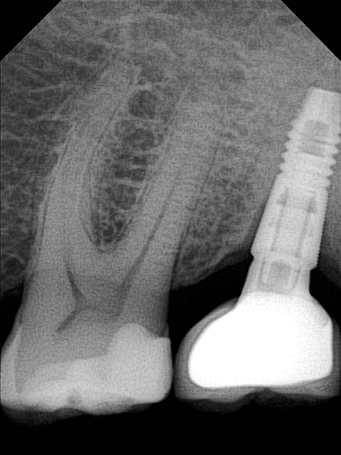 New OPTEO Dental Sensor - High-definition, reliable, and durable