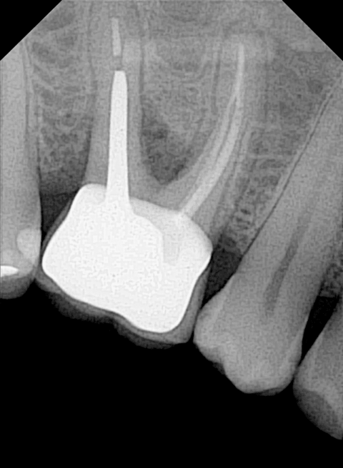 New OPTEO Dental Sensor - High-definition, reliable, and durable