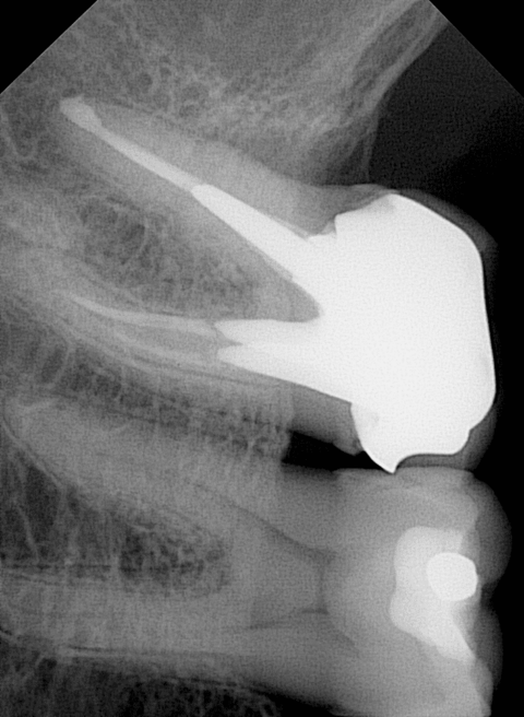 New OPTEO Dental Sensor - High-definition, reliable, and durable